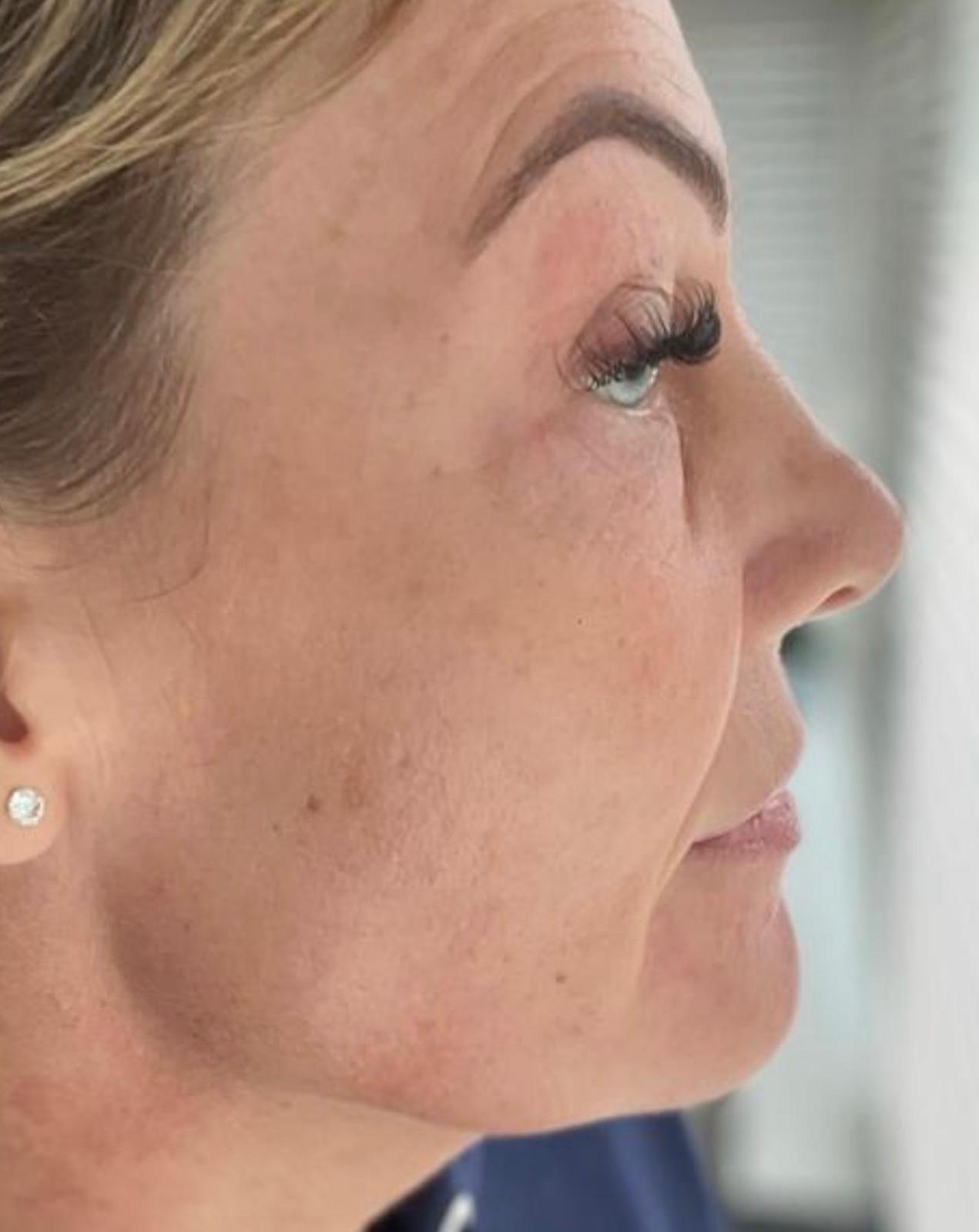 Haute Lift Cream | Amanda Caroline Skincare – Amanda Caroline Beauty